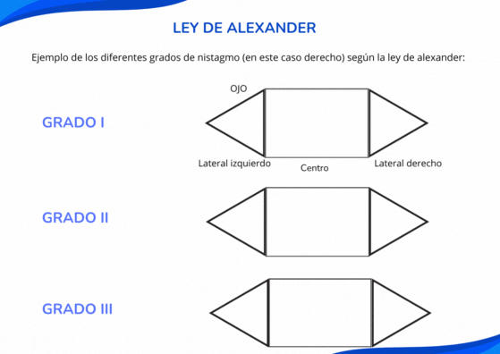 Nistagmo – Otoneurología para estudiantes